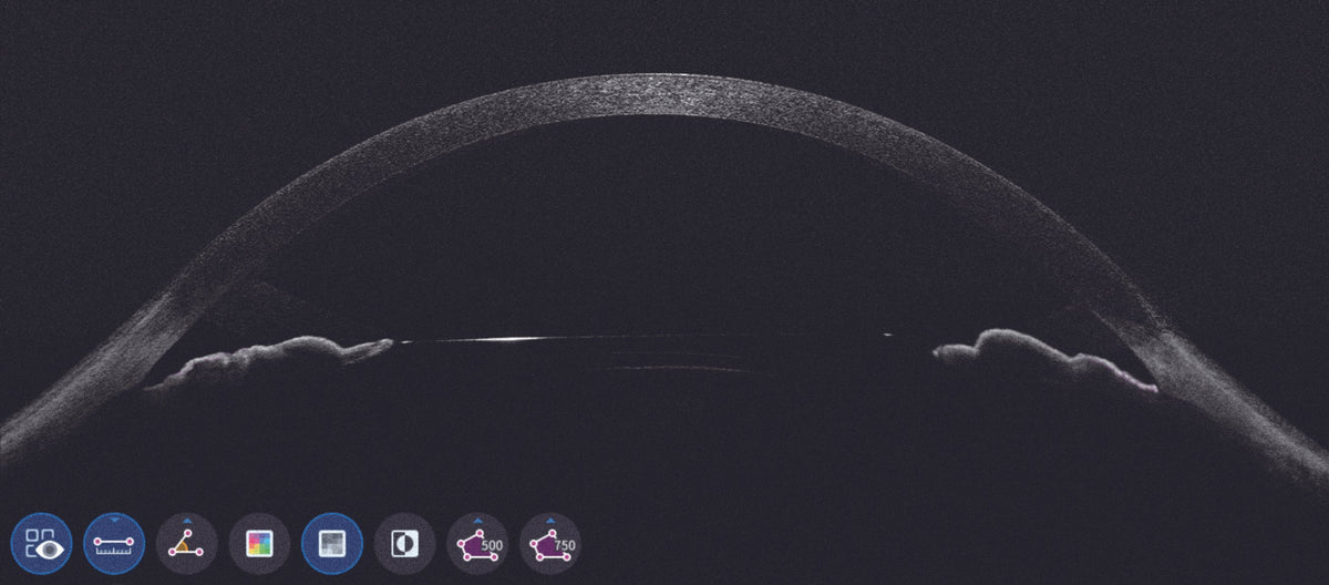 HOCT-Biometry Module Huvitz Módulo de Biometría | US Ophthalmic – US ...