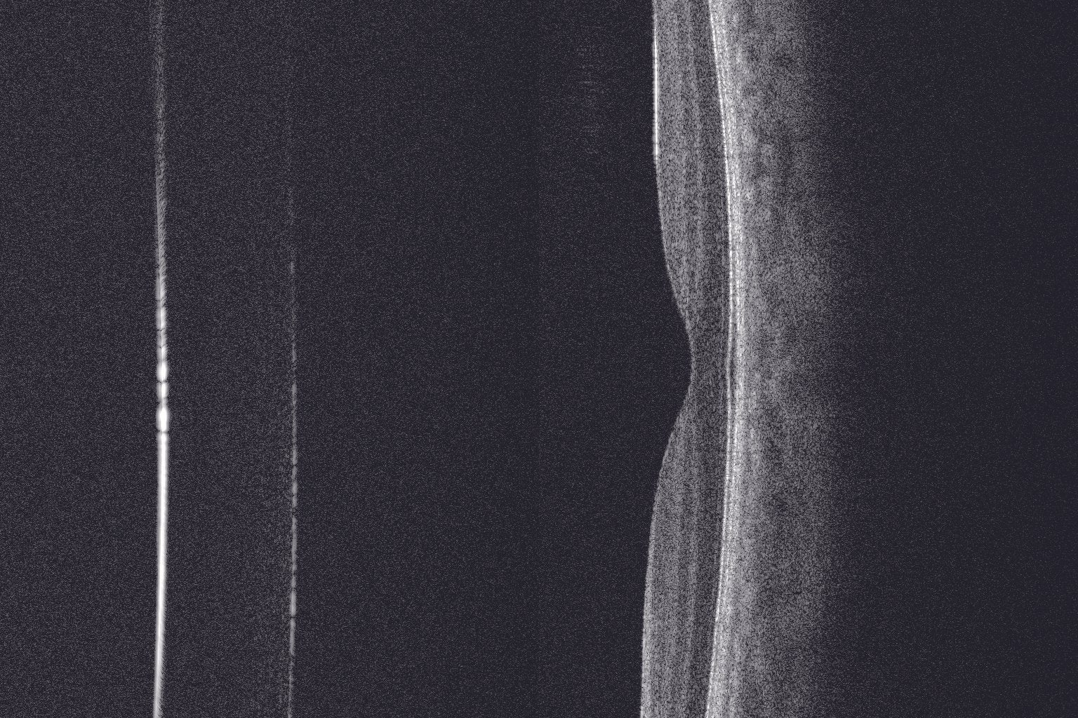 HOCT-Biometry Module Huvitz Módulo de Biometría | US Ophthalmic – US ...